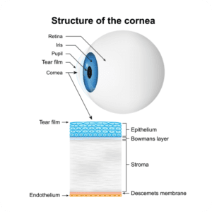 Corneal Disease